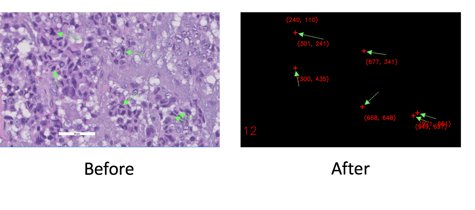 Mitosis Image Processing Part 1 Template Matching Using OpenCV Tony 